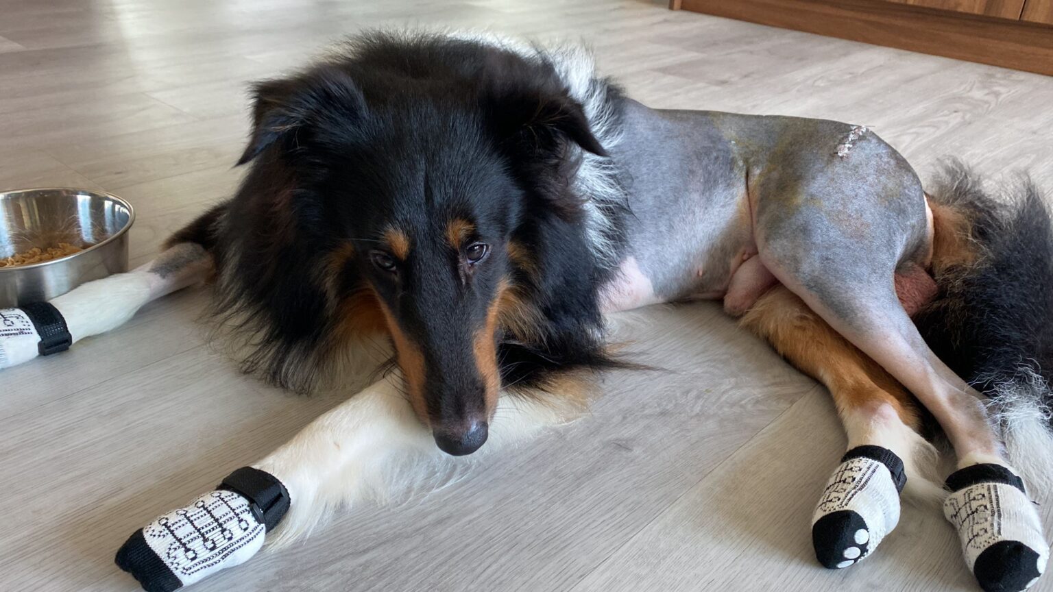 Asahi’s Double Hip Surgery Success at Beecroft Hospital